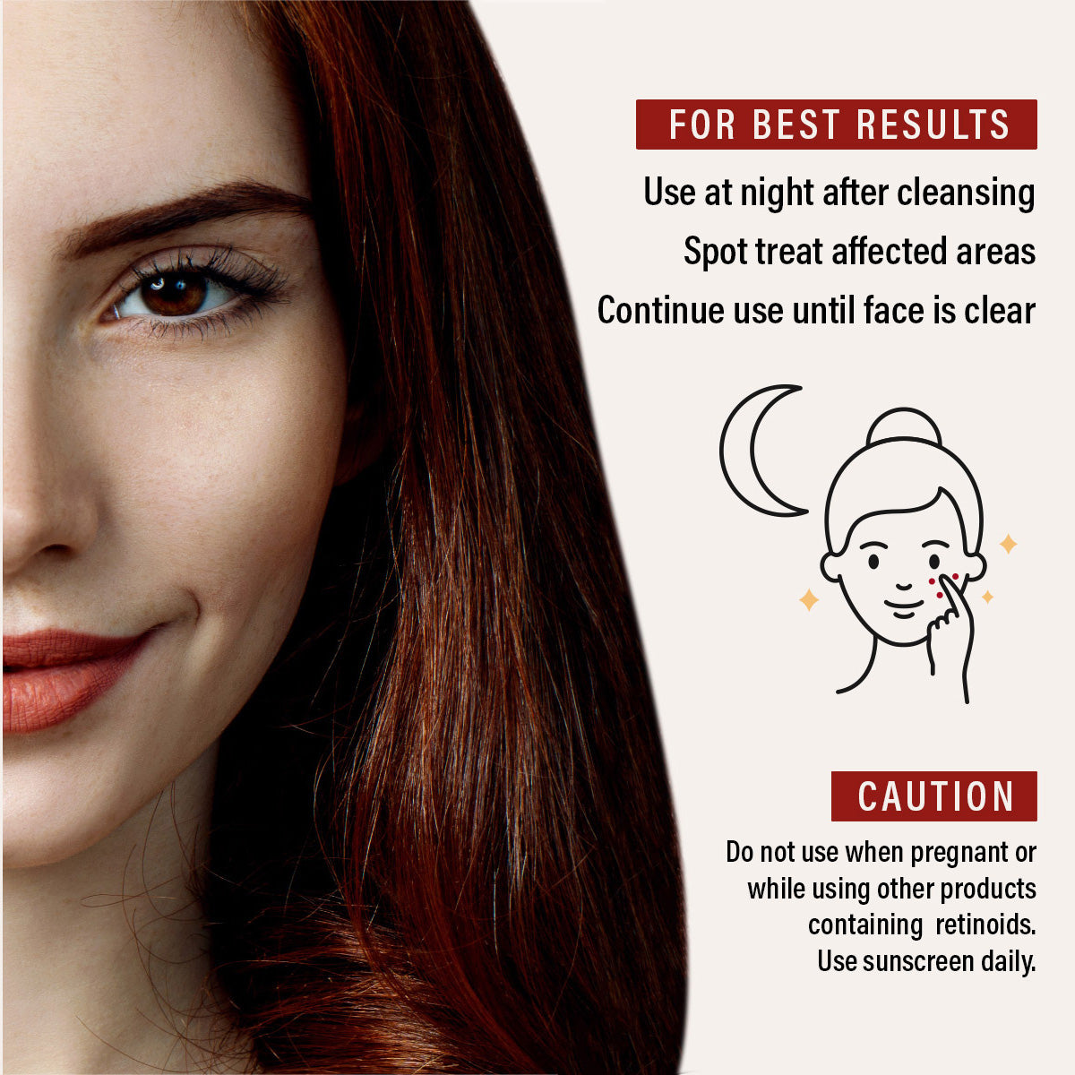 Stop Zit! Anti-Acne Retinol Complex 1 oz – Best Face & Body